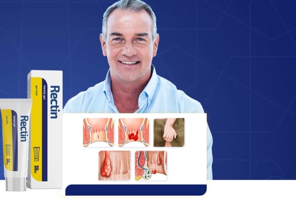 Rectin Vélemények – gél, amely eltávolítja az aranyér égő érzését